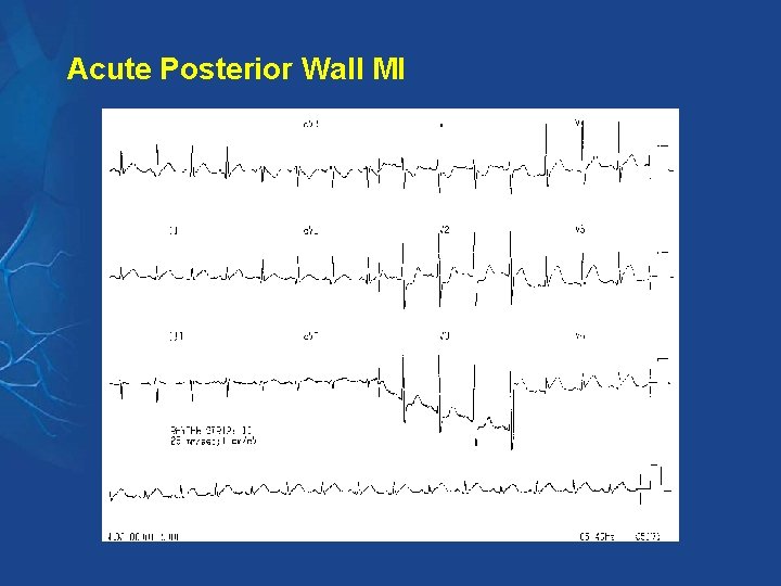 ISCHEMIC HEART DISEASE Akram Saleh MD FRCP Director