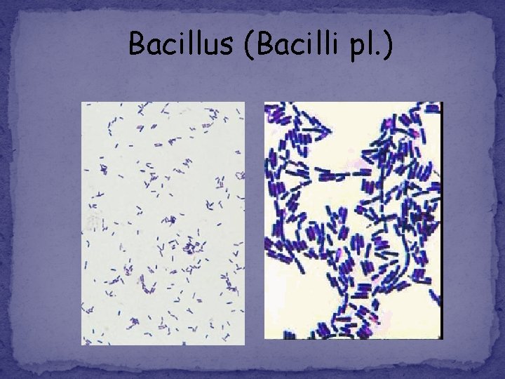 Purpose To recognize three basic shapes of bacterial