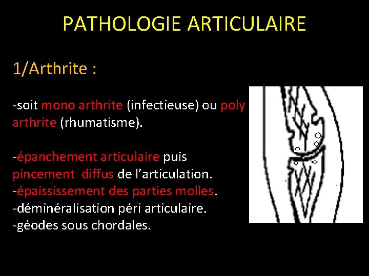 IMAGERIE OSTEO ARTICULAIRE DR N BENATALLAH INTRODUCTION Pathologie