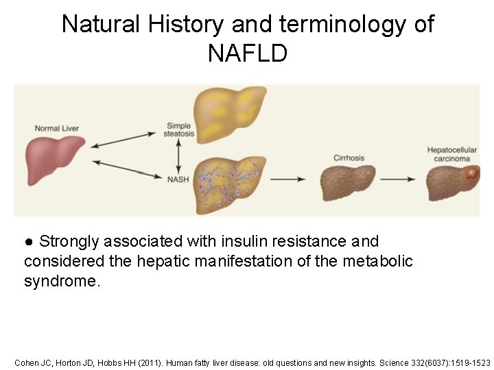 Nonalcoholic fatty liver disease and when to refer