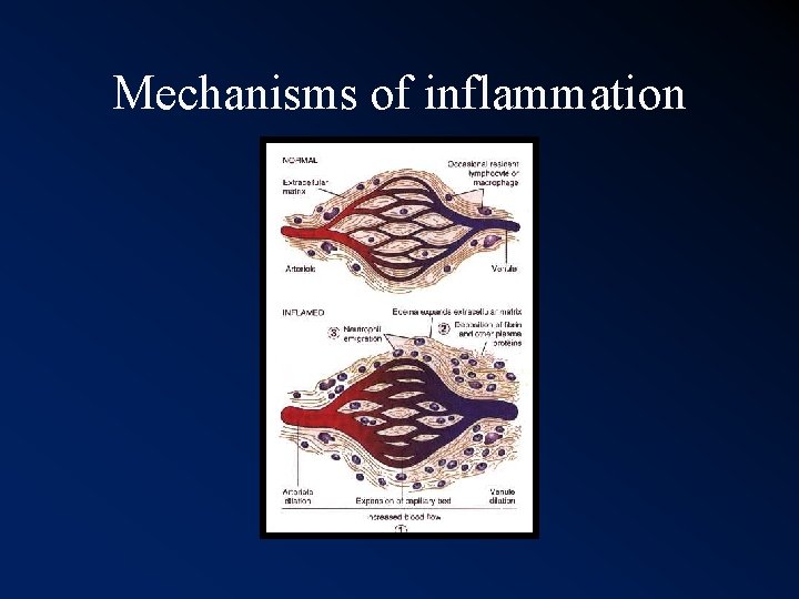 Inflammation Inflammation The response of living vascularised tissues