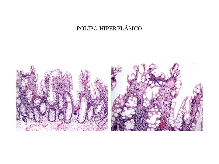 RECUERDO HISTOLGICO DEL COLON Funcin reabsorcin de lquidos