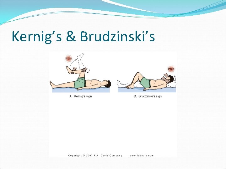 The Nervous System Nursing Care of Patients with