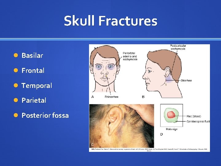 Acute Intracranial Problems Megan Mc Clintock MS RN
