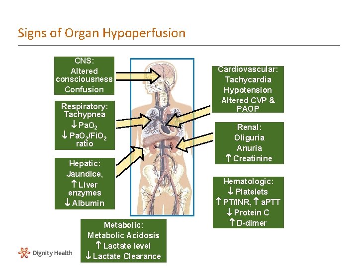 Incidence Definitions Pathophysiology Prevalence of Severe Sepsis Septic