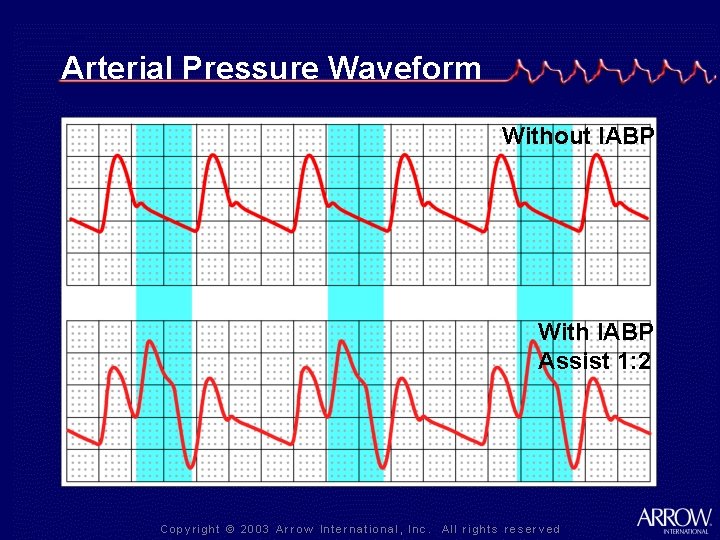 Timing How is proper timing achieved Always performed