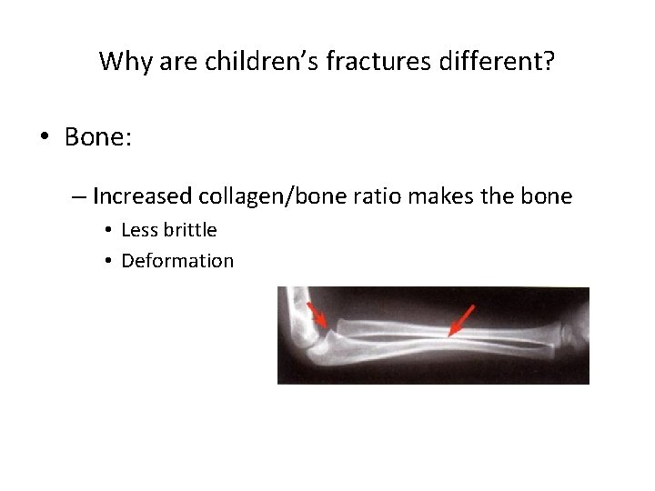 Common Pediatric Fractures and Trauma Prof Mohamed Zamzam