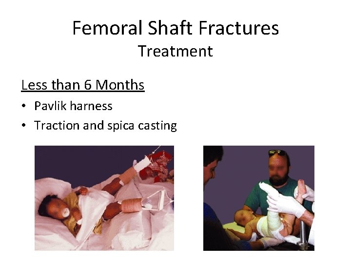 Common Pediatric Fractures and Trauma Prof Mohamed Zamzam