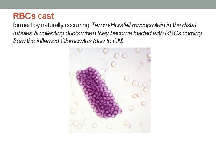 GLOMERULAR DISEASES MED 341 Nov 27 2016 Objectives