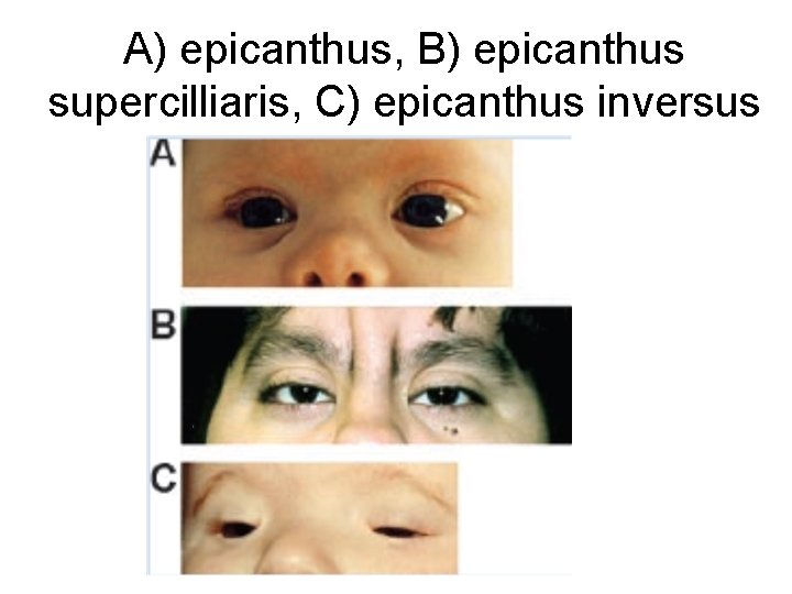 Elements of Morphology Standard Terminology for the Periorbital