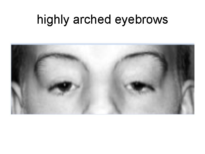 Elements of Morphology Standard Terminology for the Periorbital