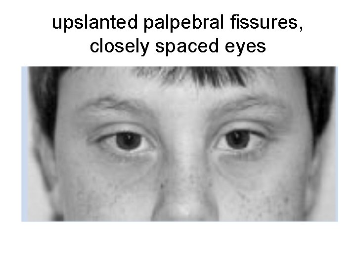 Elements of Morphology Standard Terminology for the Periorbital