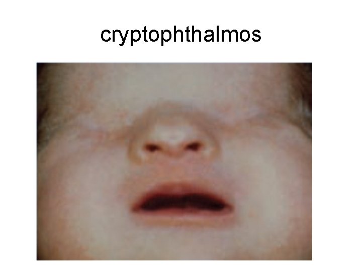 Elements of Morphology Standard Terminology for the Periorbital