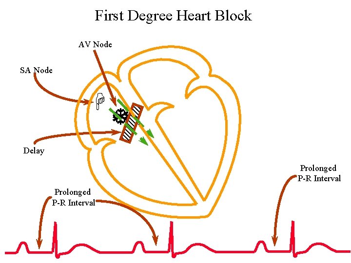 Electrocardiography Abnormalities Arrhythmias 7 Faisal I Mohammed MD