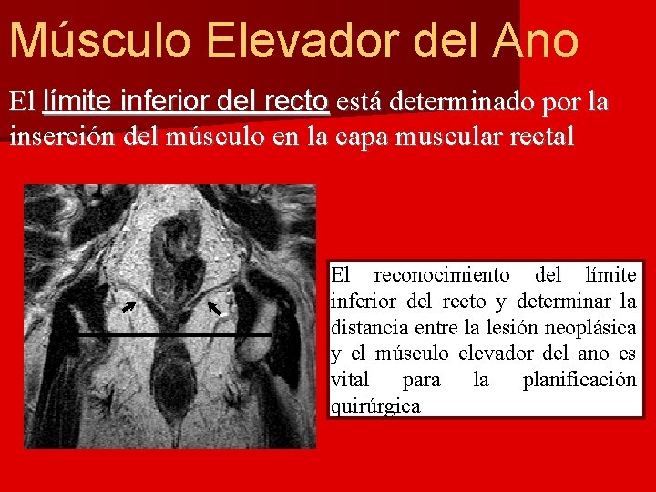 OBJETIVOS Destacar el papel de la Resonancia Magntica