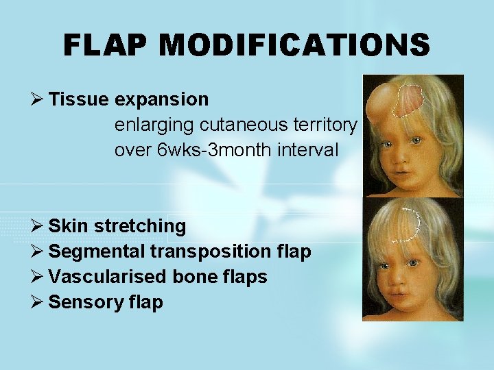 FLAPS IN RECONSTRUCTIVE SURGERY NANDINI PRASAD History Sage