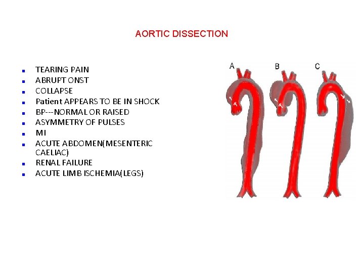 Approach to Chest pain Dr Duaa Hiasat Chest