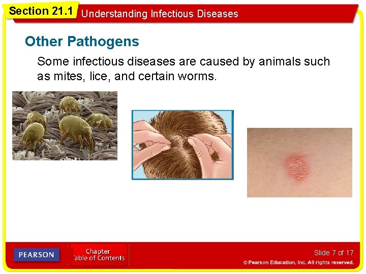 Section 21 1 Understanding Infectious Diseases Myth There