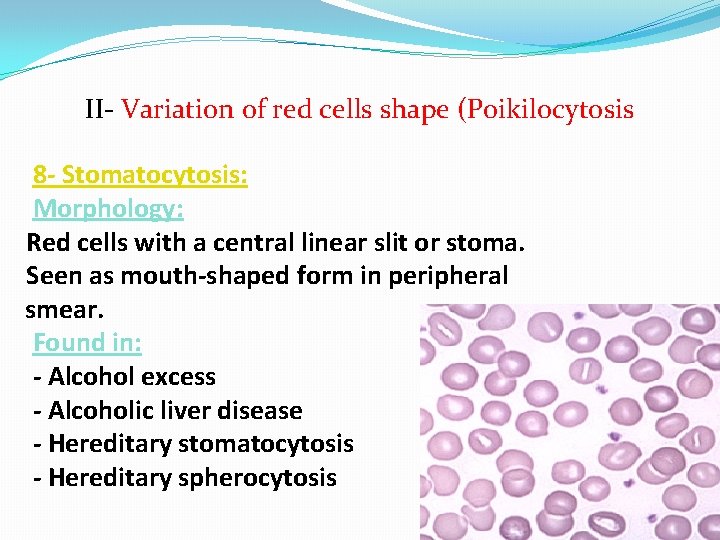 Hematology Morphology of RCB in health and disease