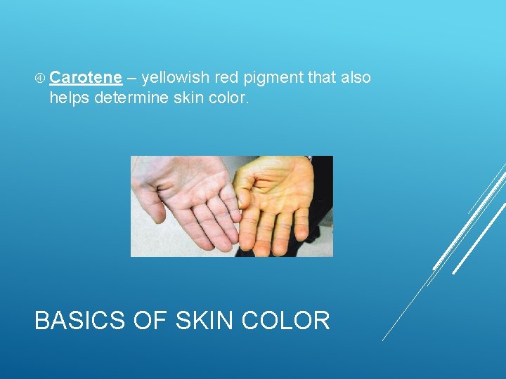 PIGMENTATION DHO Ch 7 3 Pg 153 Basic