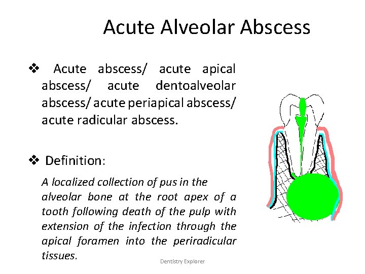 Diseases of the Periradicular Tissue DEPARTMENT OF ORAL