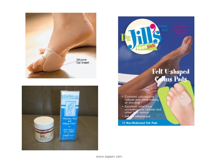 www aappm com Matrixectomy Amerigel Postop Matrixectomy kit