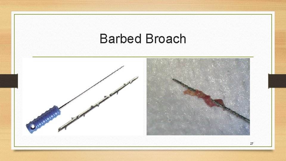 Endodontics AKA Root Canal Therapy RCT 1 Describe