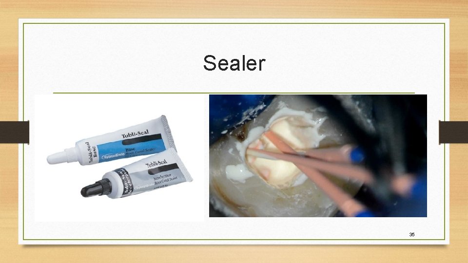 Endodontics AKA Root Canal Therapy RCT 1 Describe