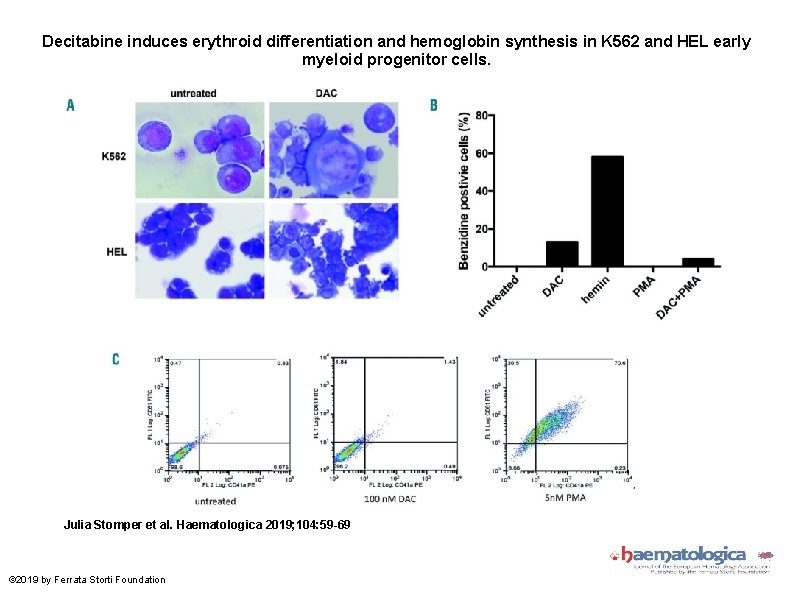 Fetal hemoglobin induction during decitabine treatment of elderly