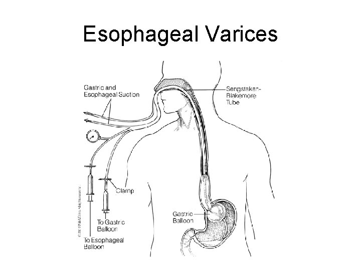 Liver Gall Bladder and Pancreatic Disease Manifestations of
