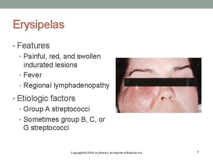 CHAPTER 76 Skin Soft Tissue and Wound Infections