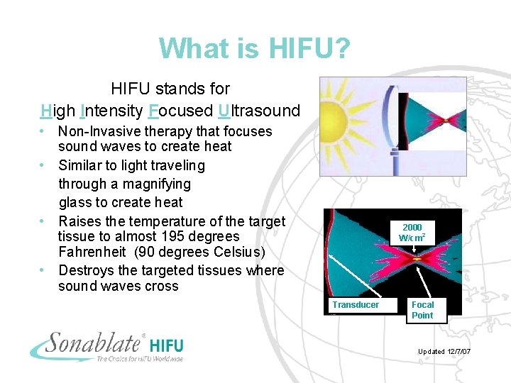 High Intensity Focused Ultrasound Sonablate HIFU A Non