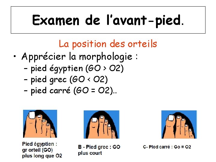 SEMIOLOGIE DU PIED ET CHEVILLE Emilie Acquacalda Rhumatologie