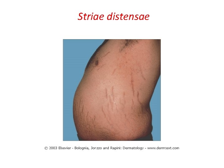Cutaneous Manifestation of Systemic disease By Dr Eman