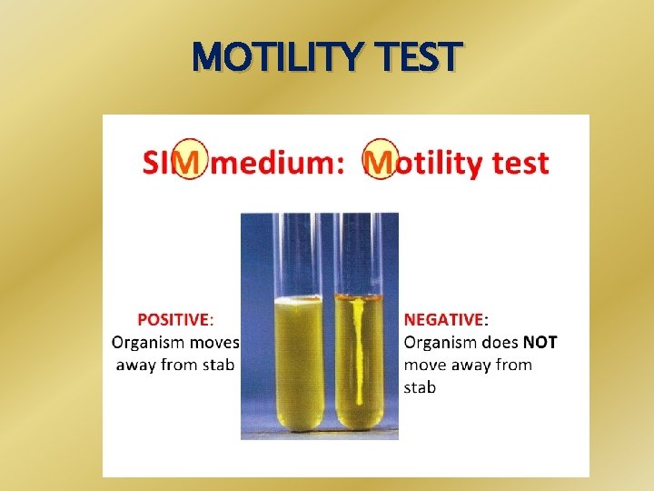 SALMONELLA SHIGELLA GIT BLOCK Prof Ali Somily Prof
