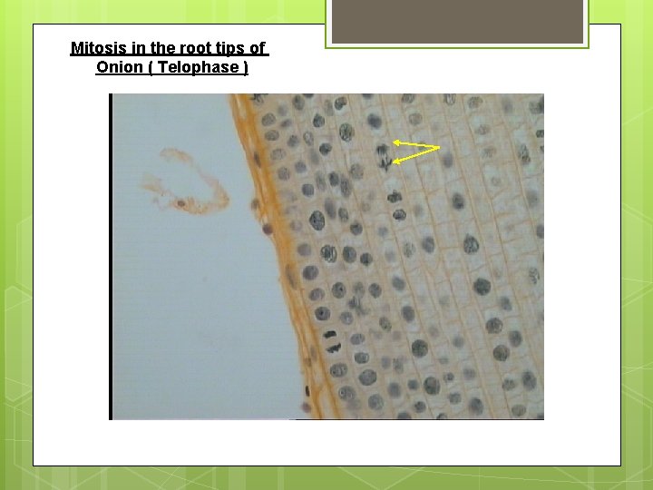 Mitosis in the root tips of Onion Squash