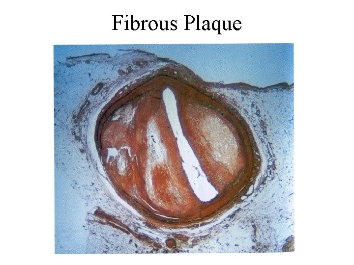 Circulatory System Blood Formed Elements erythrocytes hemoglobin leukocytes