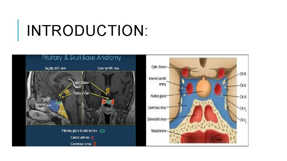 APPROACH TO SELLAR MASS AND PITUITARY STALK LESIONS
