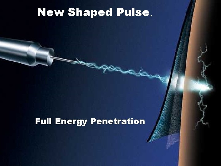 From Traditional New Shaped Blunt Pulse Arc Phase