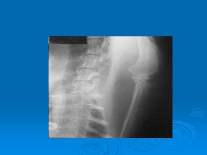 Small Animal Forelimb Ch 13 Scapula Two methods