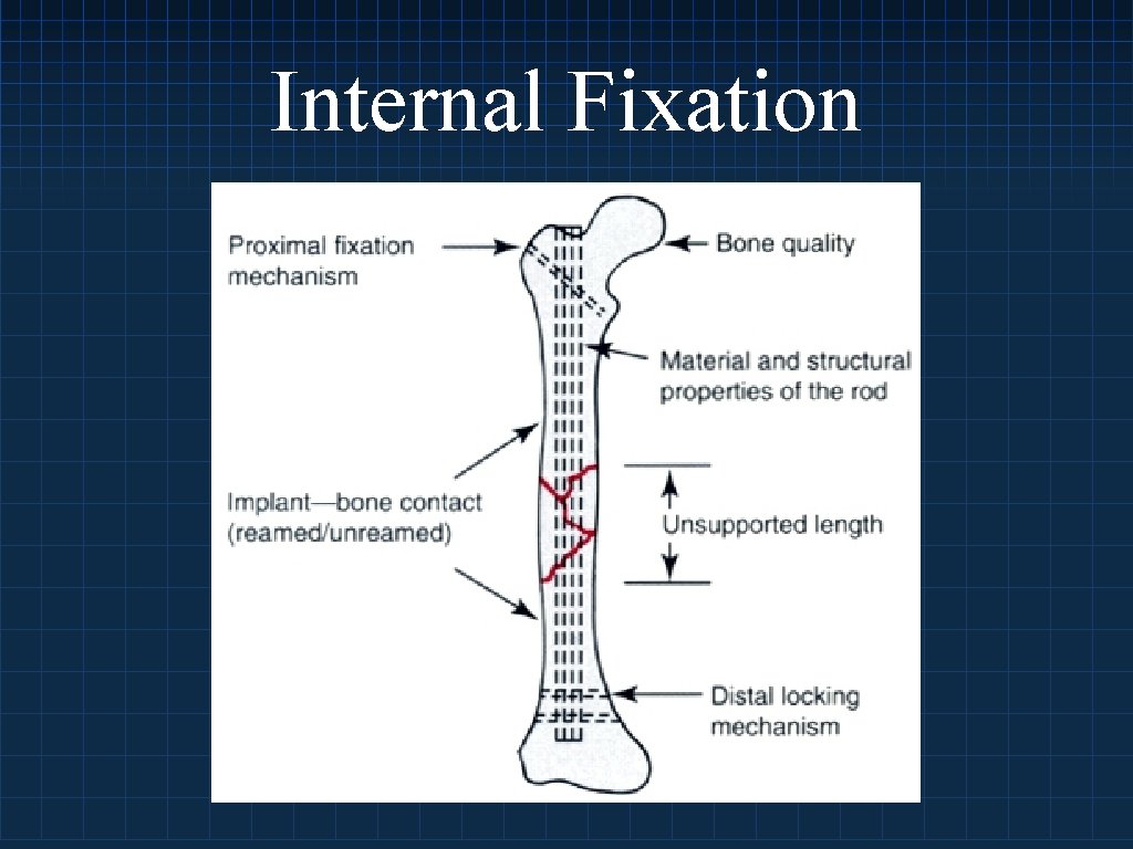 Orthopedic Hardware Problems Todd R Wilcox MD MBA