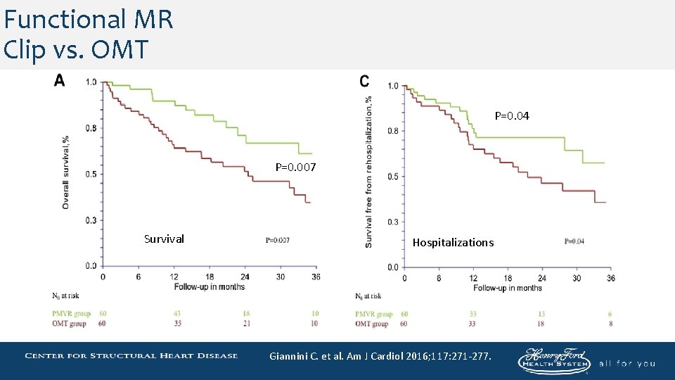 Functional MR When to Intervene An Interventional Cardiologists