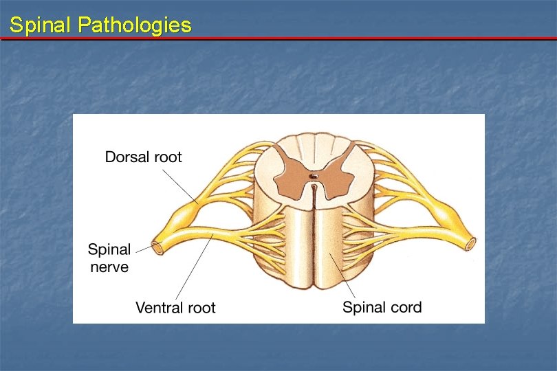 Spinal Cord Compression Spine Fractures Department of Neurosurgery
