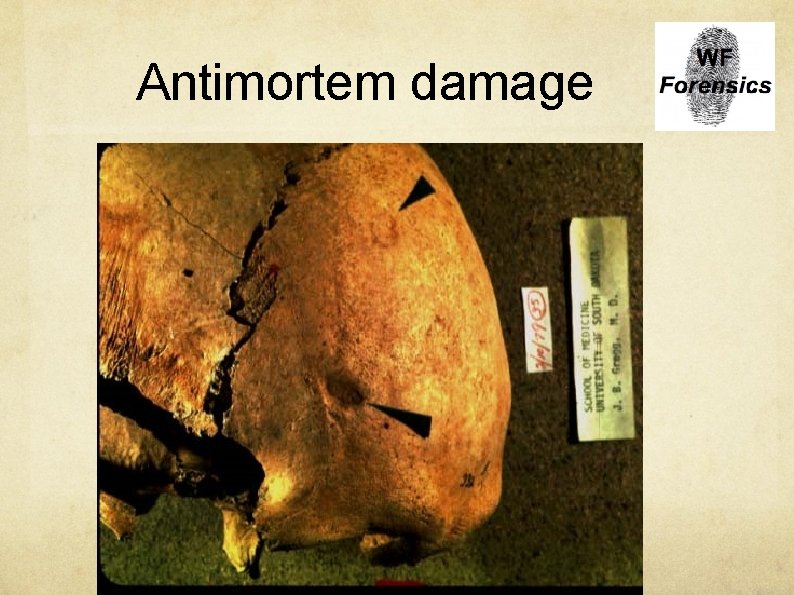 UNIT 3 FORENSIC ANTHROPOLOGY IMPRESSIONS Objective Identifying Male
