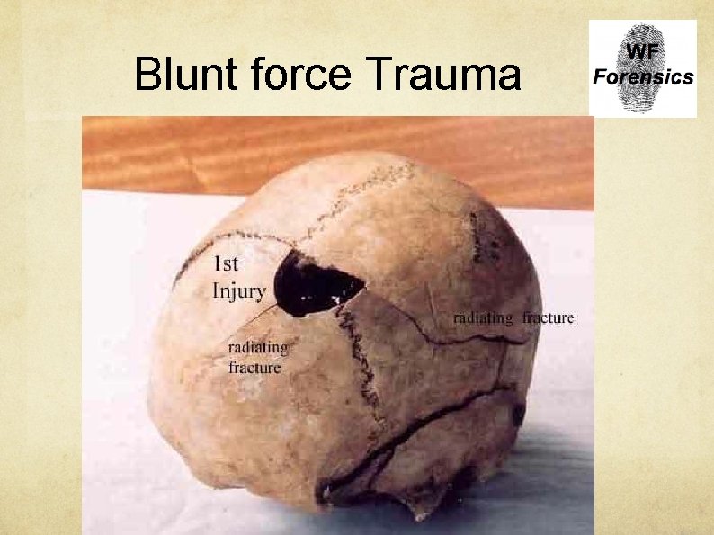 UNIT 3 FORENSIC ANTHROPOLOGY IMPRESSIONS Objective Identifying Male