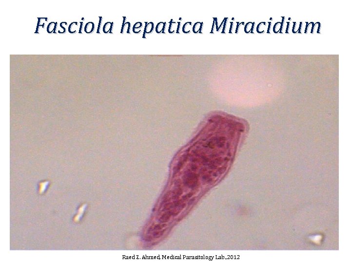 Liver Flukes Fashiola spp Raed Z Ahmed Medical