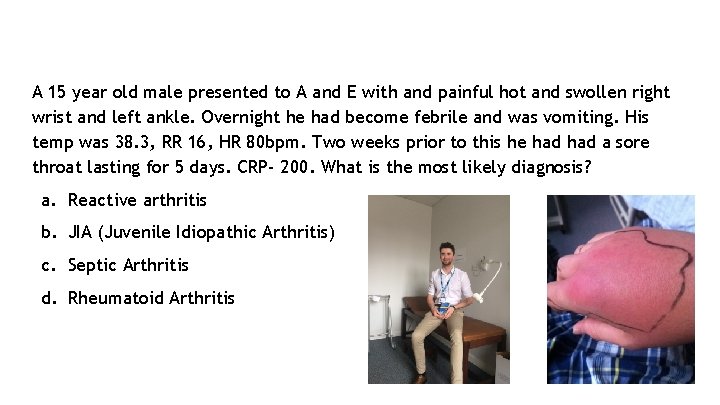 Rheumatology Anna and Esther Joint Pain Inflammatory Autoimmune