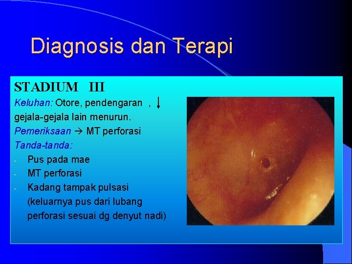 GANGGUAN TELINGA TENGAH GANGGUAN TELINGA TENGAH 1 2