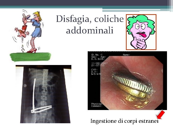 I DOLORI ADDOMINALI RICORRENTI UN PROTOCOLLO DA CONDIVIDERE