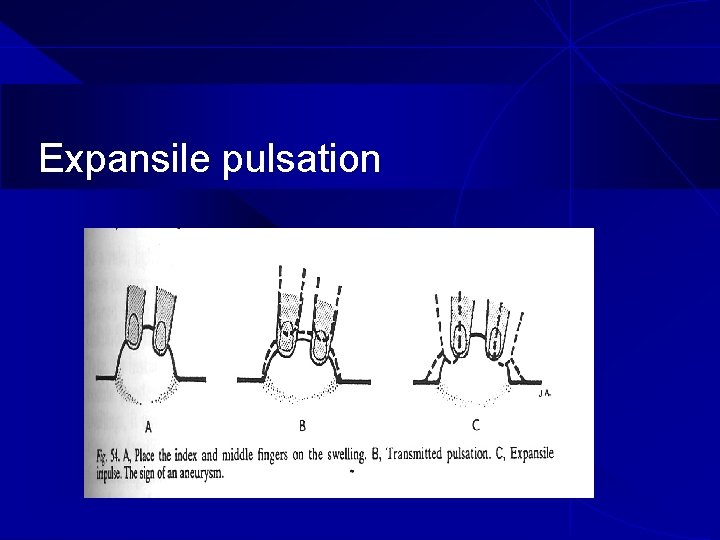 Acute Abdomen Nurhayat Usman dr Sp BKBD 342021